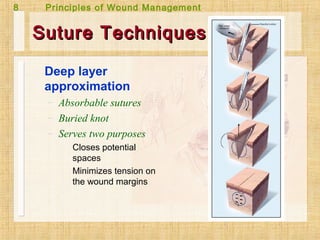 Wound management | PPT