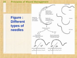 Wound management | PPT
