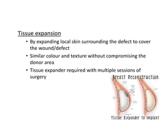 Wound management | PPTX