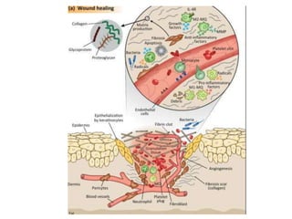 Wound management | PPTX