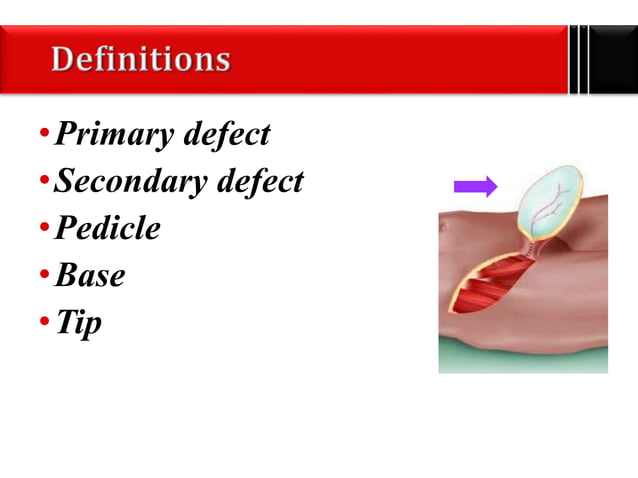 Wound Defect management | PPT