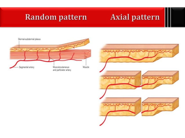 Wound Defect management | PPT