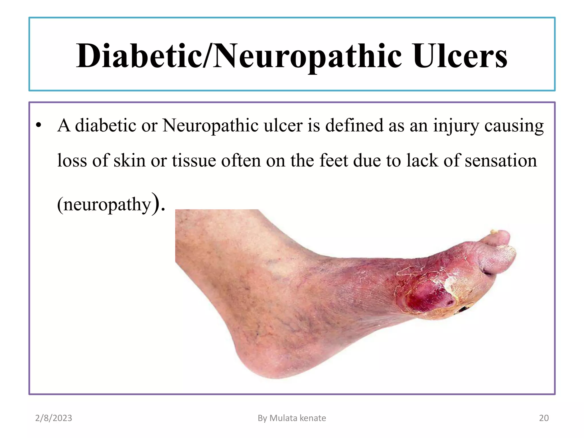 Wound management.pptx