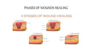 WOUND MANAGEMENT.pptx