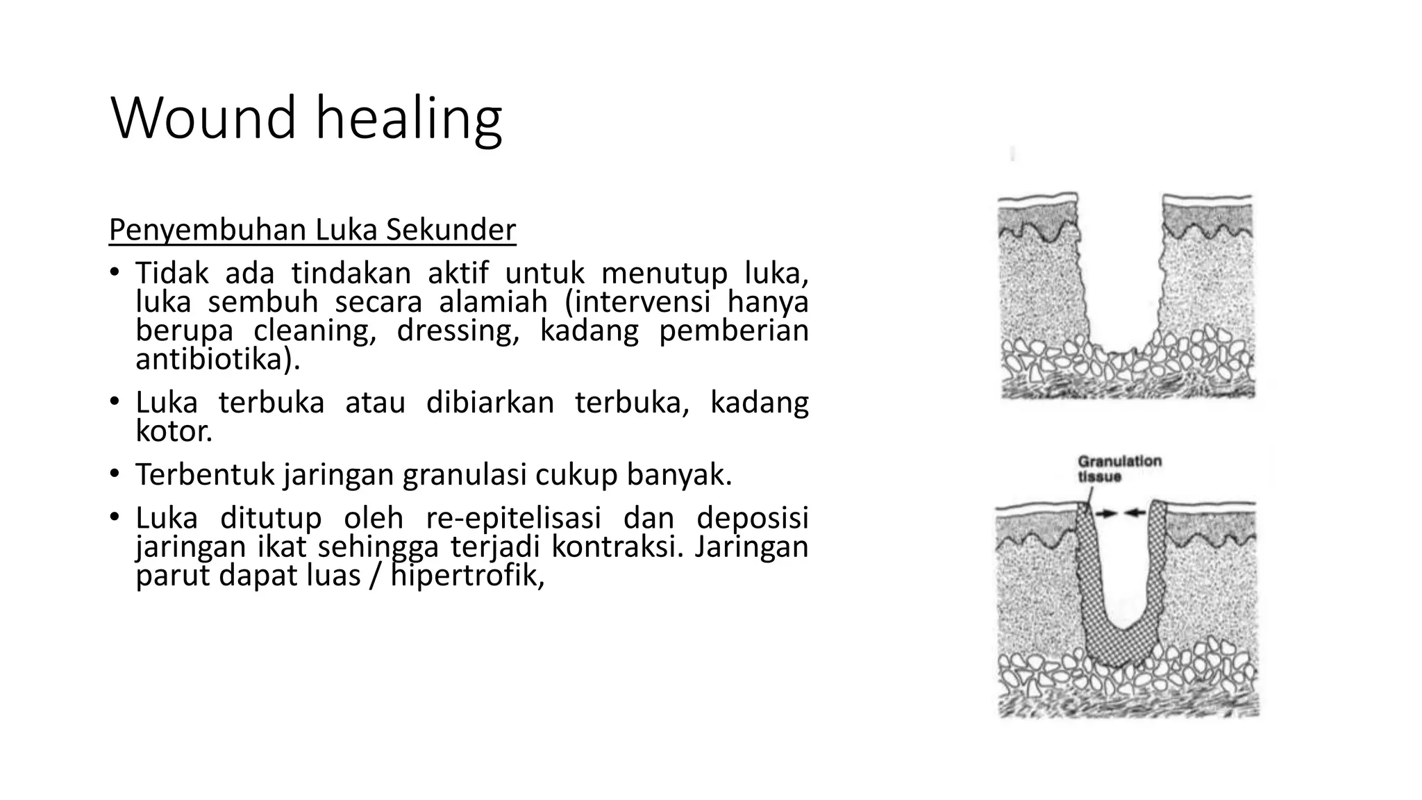 Wound Management.pptx