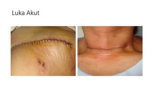 Wound Management.pptx