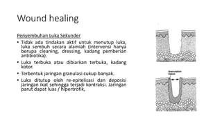 Wound Management.pptx
