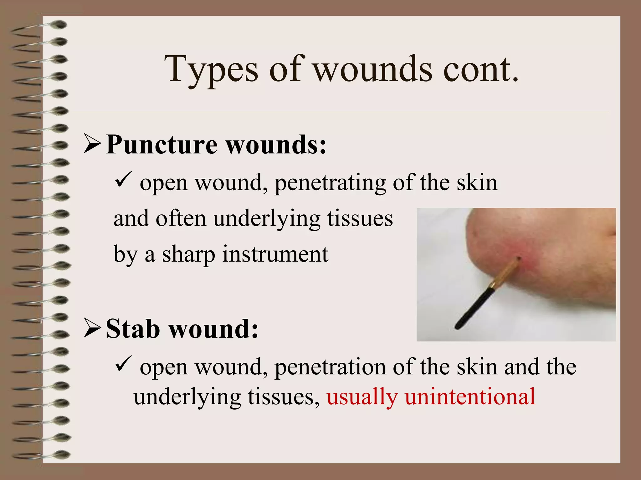 Wound management by saumya agarwal | PPTX