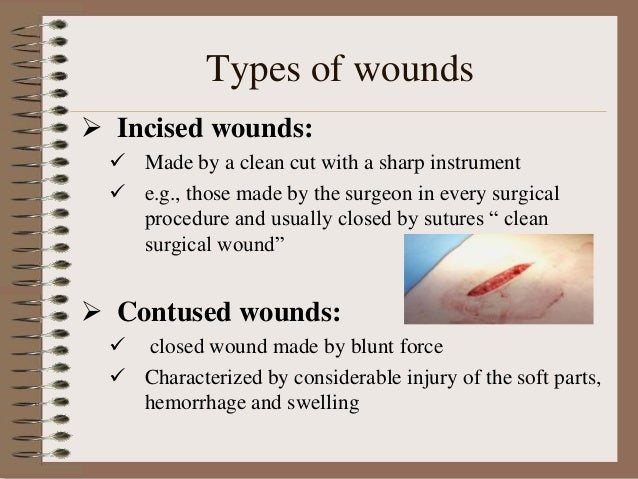 Wound management by saumya agarwal