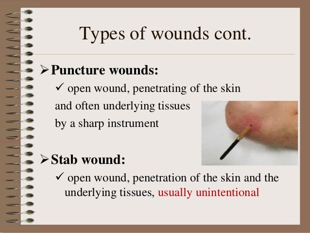 Wound management by saumya agarwal