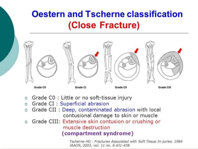 Wound management by saumya agarwal