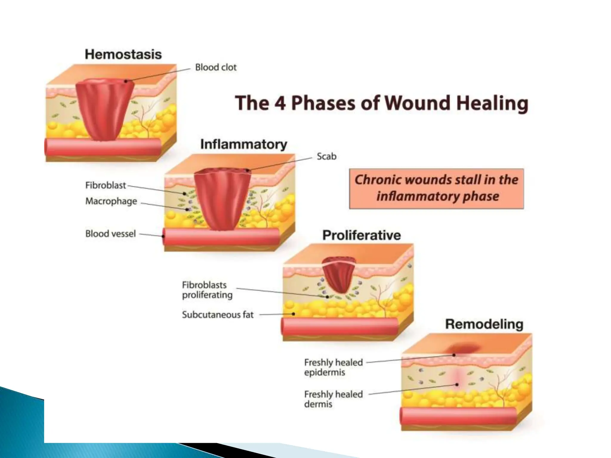 Wound Management Dressing Pptx Wound Management Pptx