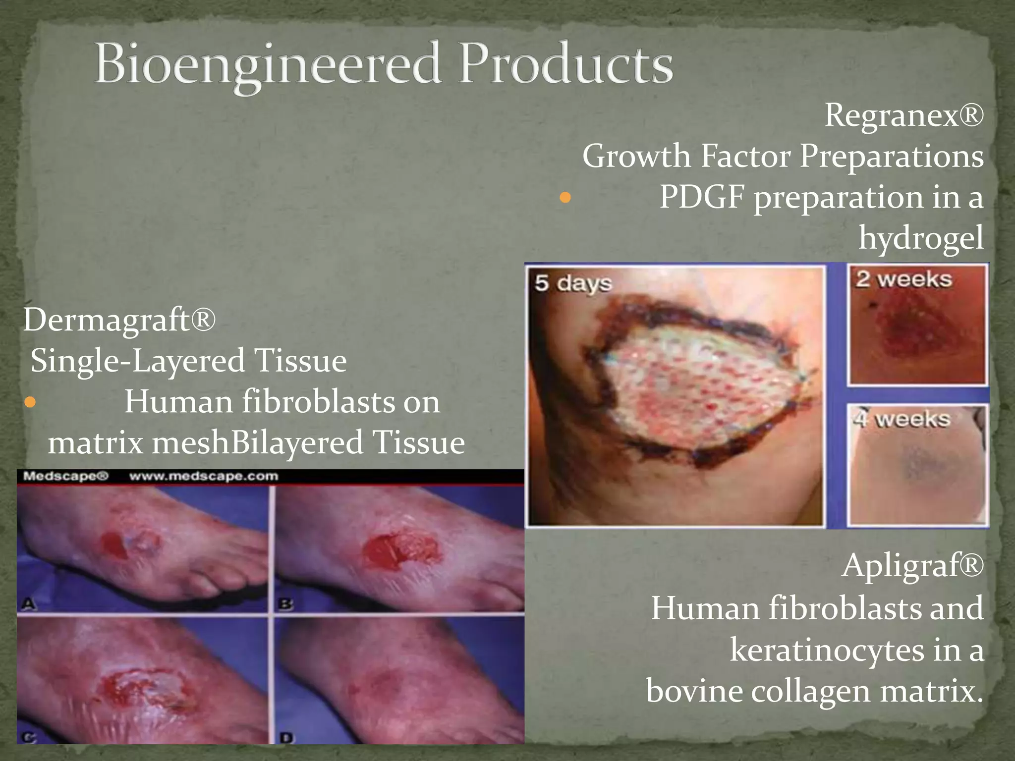 Wound management & dressings | PPTX