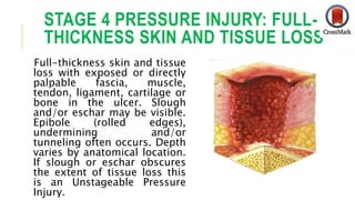Wound Management in Domiciliary Palliative Care | PPTX