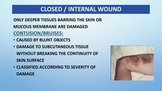 WOUND MANAGEMENT m.pdf