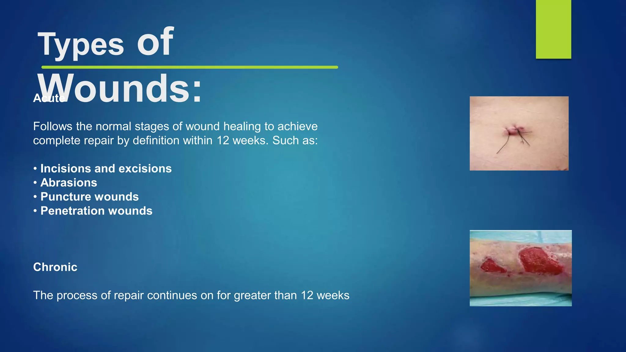 Wound managment | PPTX