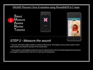Wound map pump pp 042813 | PPT