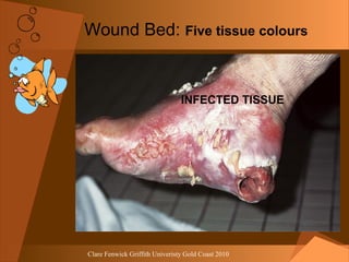 Wound physiology cf | PPT | Injuries | Diseases and Conditions