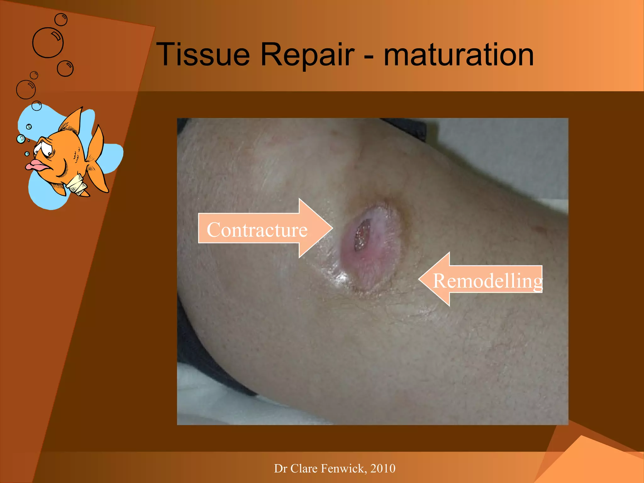 Wound physiology cf for pp | PPT
