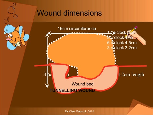 Wound physiology cf for pp