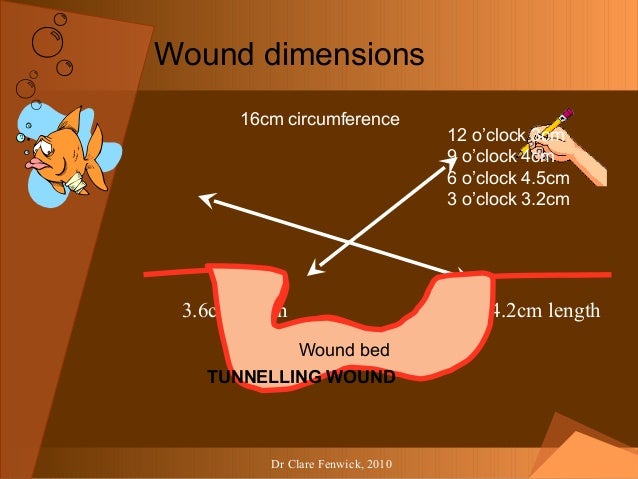 Wound physiology cf for pp