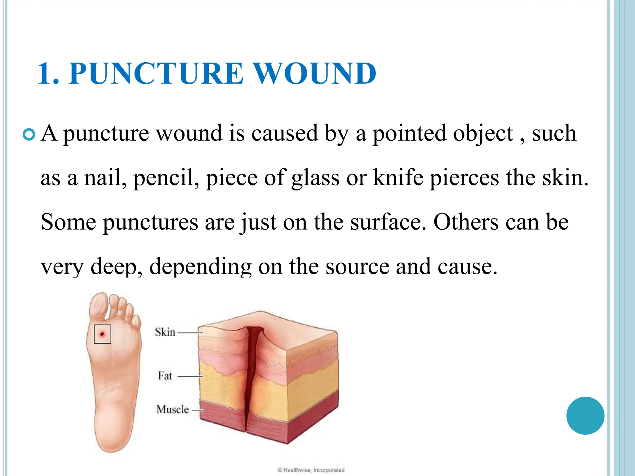 wound ppt.pptx, wound dressing , indication, types, procedure, | PPTX