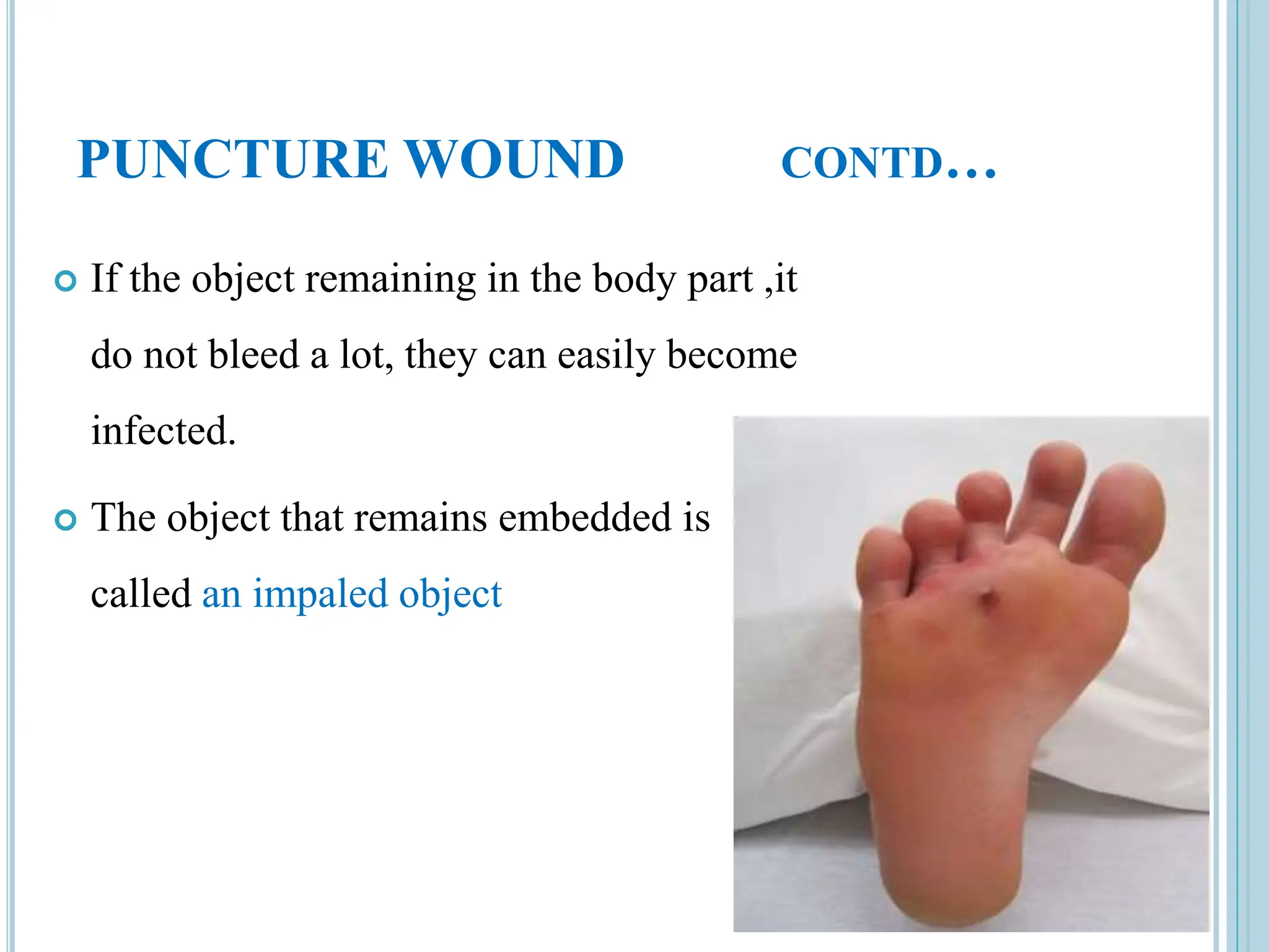 wound ppt.pptx, wound dressing , indication, types, procedure, | PPTX ...