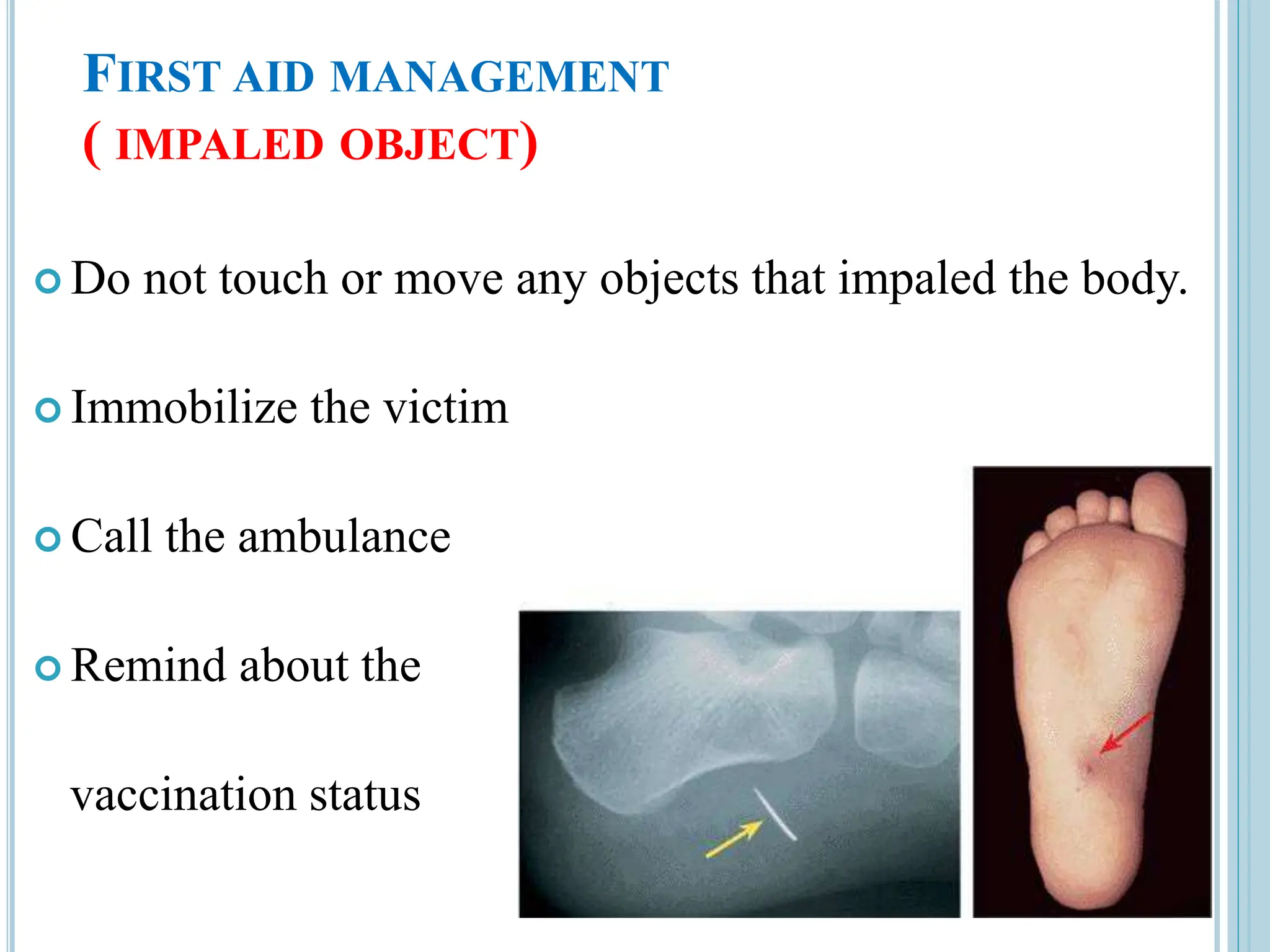 wound ppt.pptx, wound dressing , indication, types, procedure, | PPTX