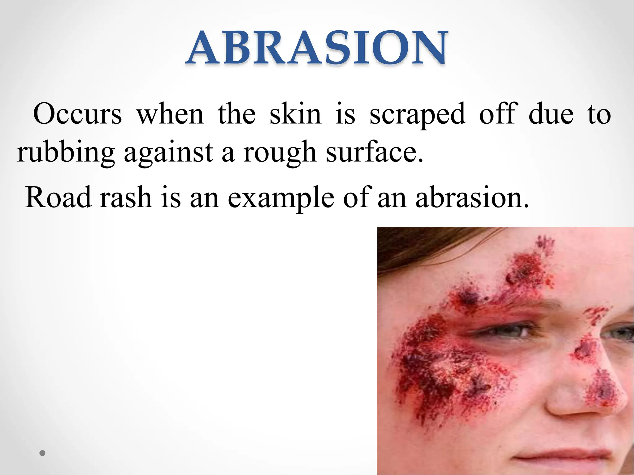 wound ppt.pptx, wound dressing , indication, types, procedure, | PPTX