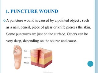 wound ppt.pptx, wound dressing , indication, types, procedure, | PPTX