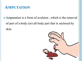 wound ppt.pptx, wound dressing , indication, types, procedure, | PPTX