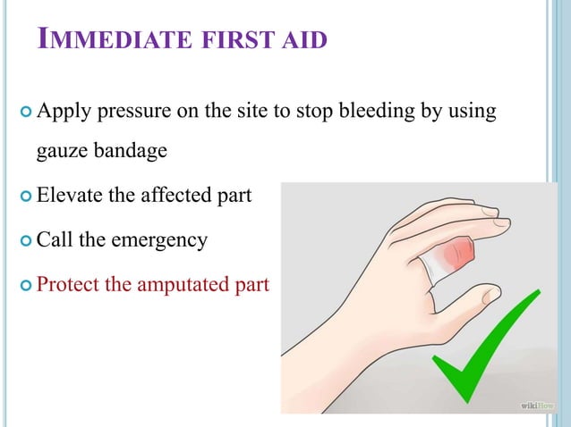 wound ppt.pptx, wound dressing , indication, types, procedure, | PPTX ...