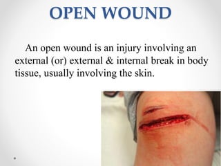 wound ppt.pptx, wound dressing , indication, types, procedure, | PPTX