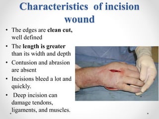 wound ppt.pptx, wound dressing , indication, types, procedure, | PPTX