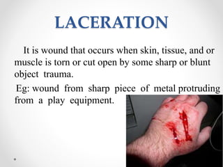 wound ppt.pptx, wound dressing , indication, types, procedure, | PPTX