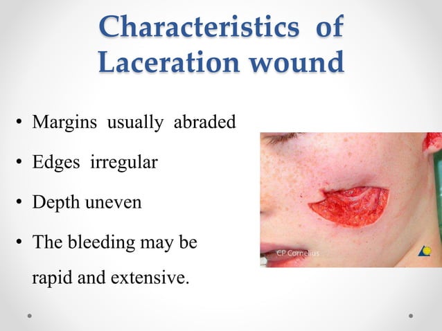 wound ppt.pptx, wound dressing , indication, types, procedure, | PPTX ...