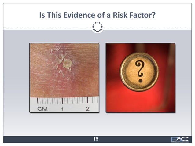 WoundRounds: Clinical Reimbursement and Wound Care webinar slides | PDF ...