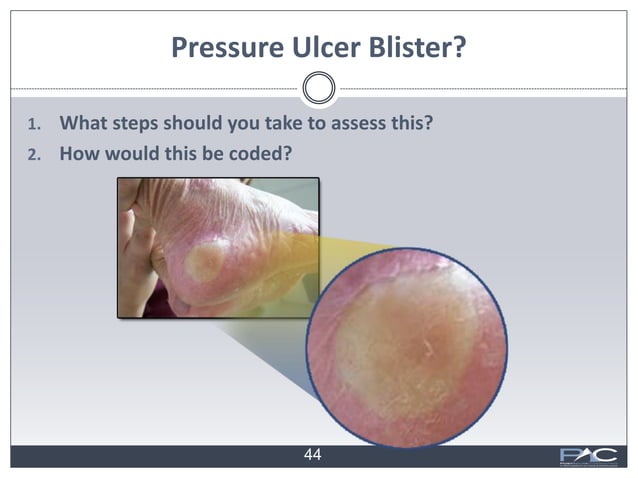 WoundRounds: Clinical Reimbursement and Wound Care webinar slides | PDF ...