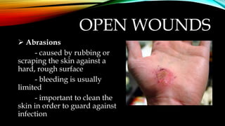 Wounds | PPTX