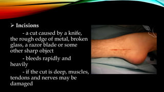 Wounds | PPTX