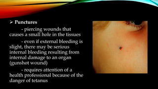 Wounds | PPTX