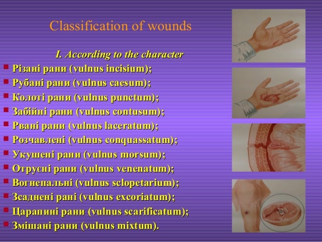 Wounds