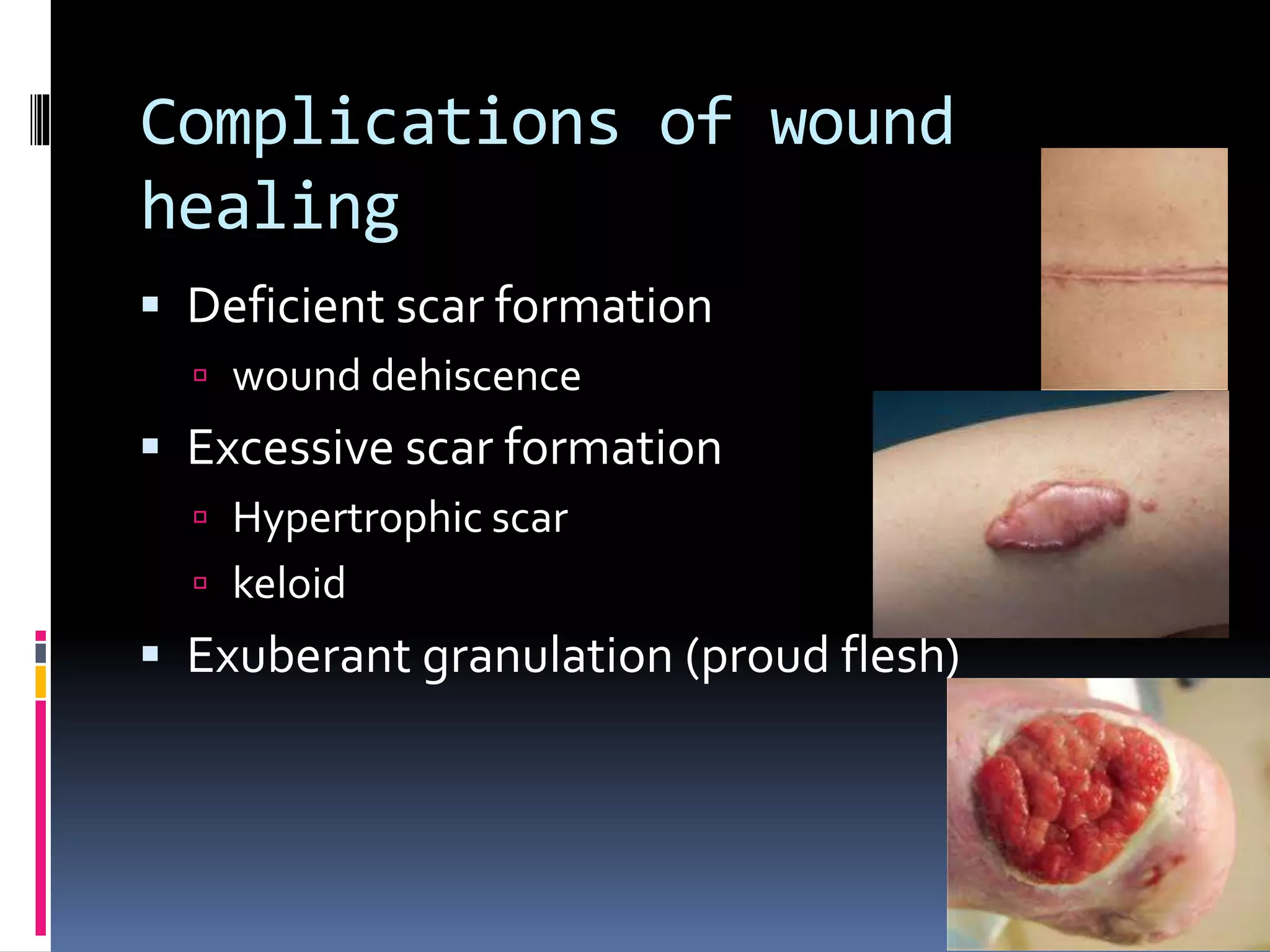 Wounds | PPTX