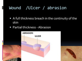 Wounds | PPTX