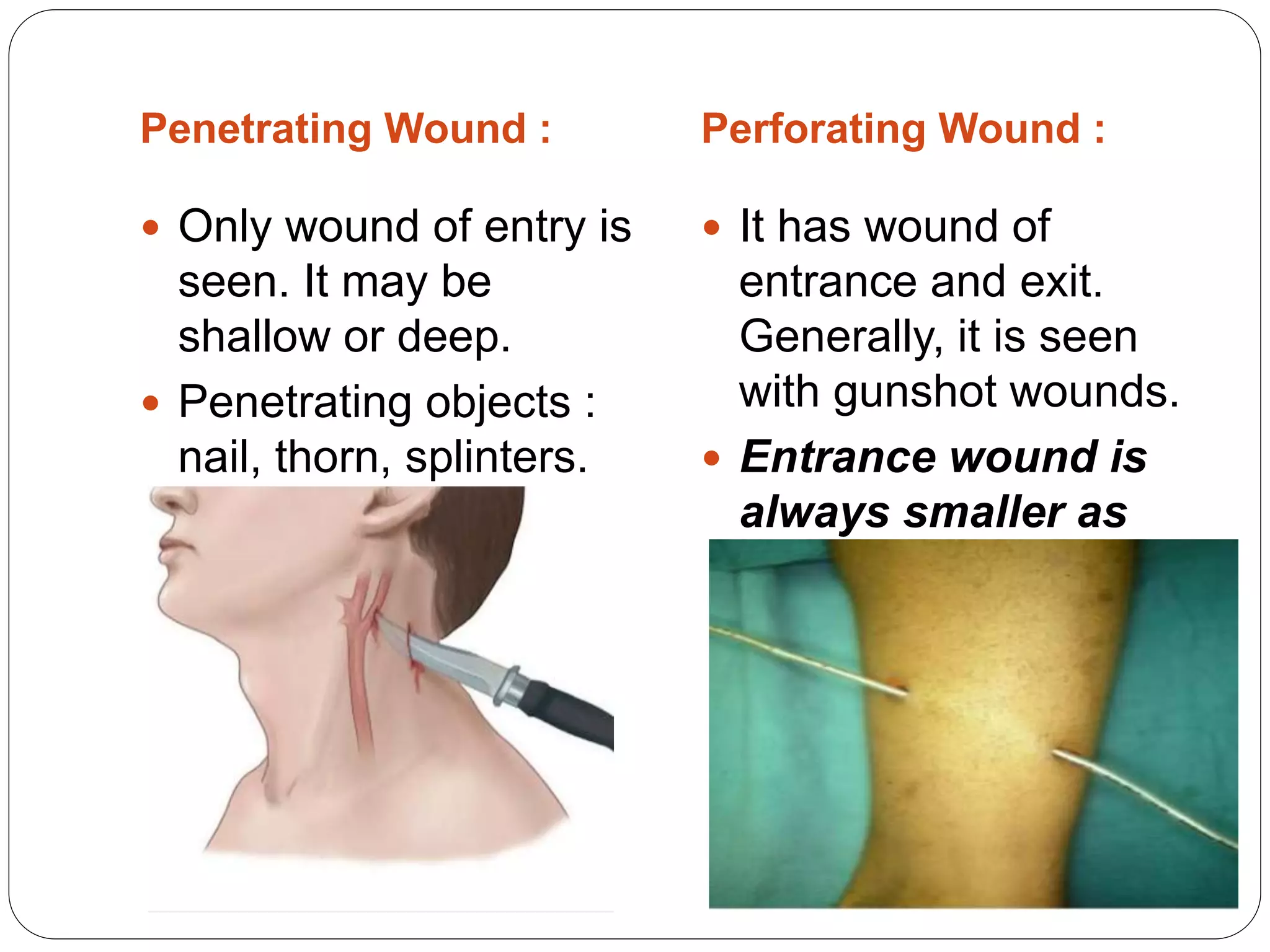 Wounds | PPTX