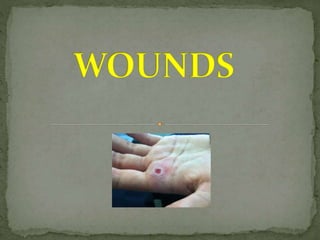 Wounds | PPTX