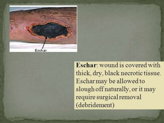 Wounds | PPT