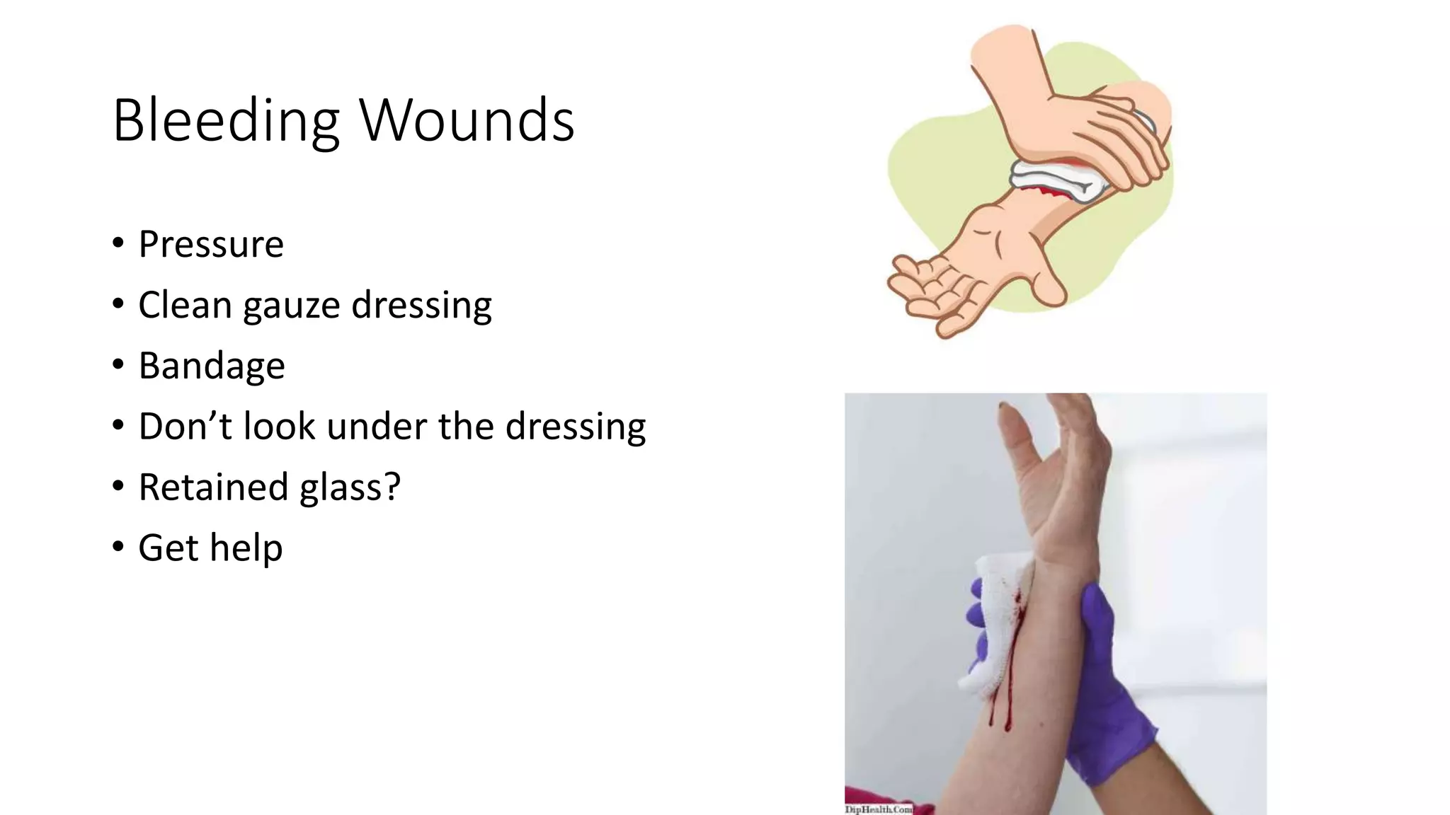 Blair Everywhere - First Aid - Wounds | PPTX