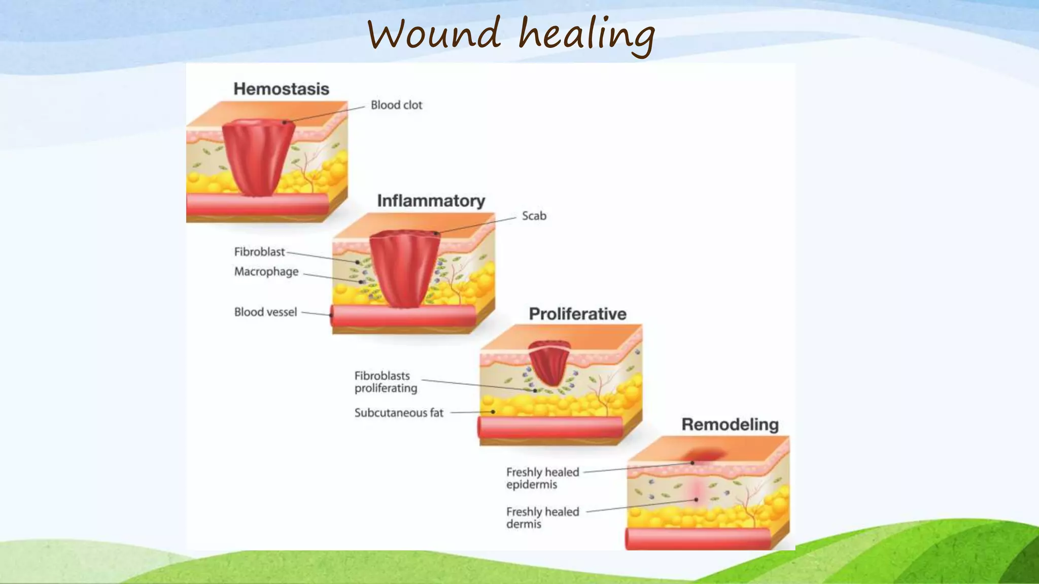 WOUNDS.pptx