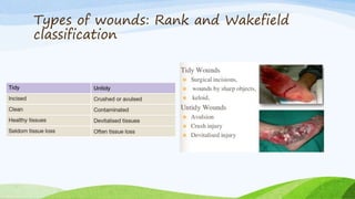 WOUNDS.pptx